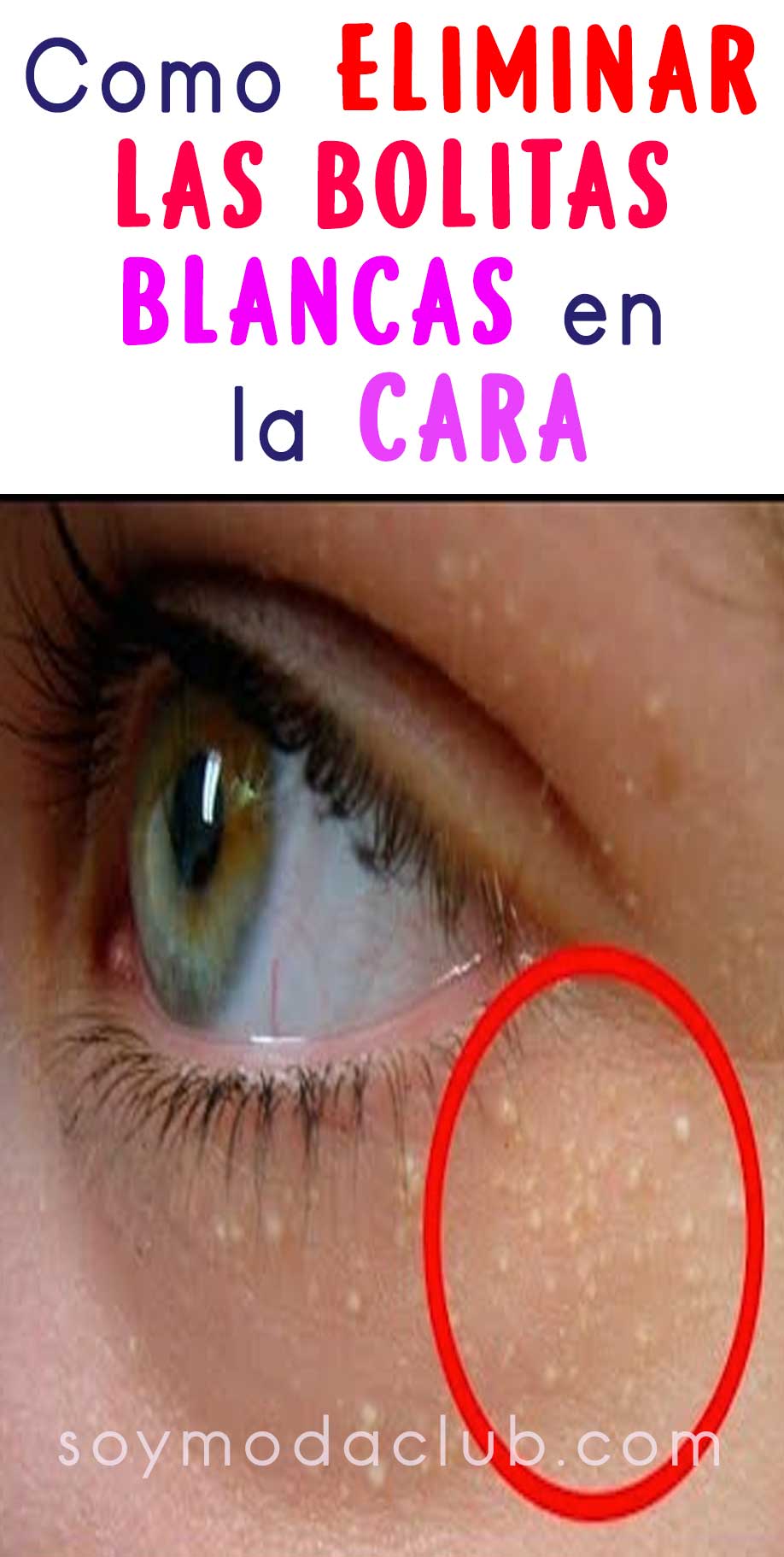 Como eliminar las bolitas blancas en la cara Como eliminar las bolitas blancas en la cara